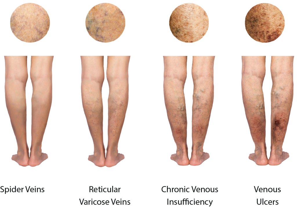 #1 Vein Clinic In Nashville | Trident Vein Center